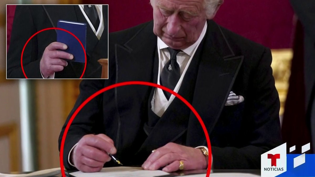 Video: las manos hinchadas y rojas del rey Carlos – Telemundo Nueva ...