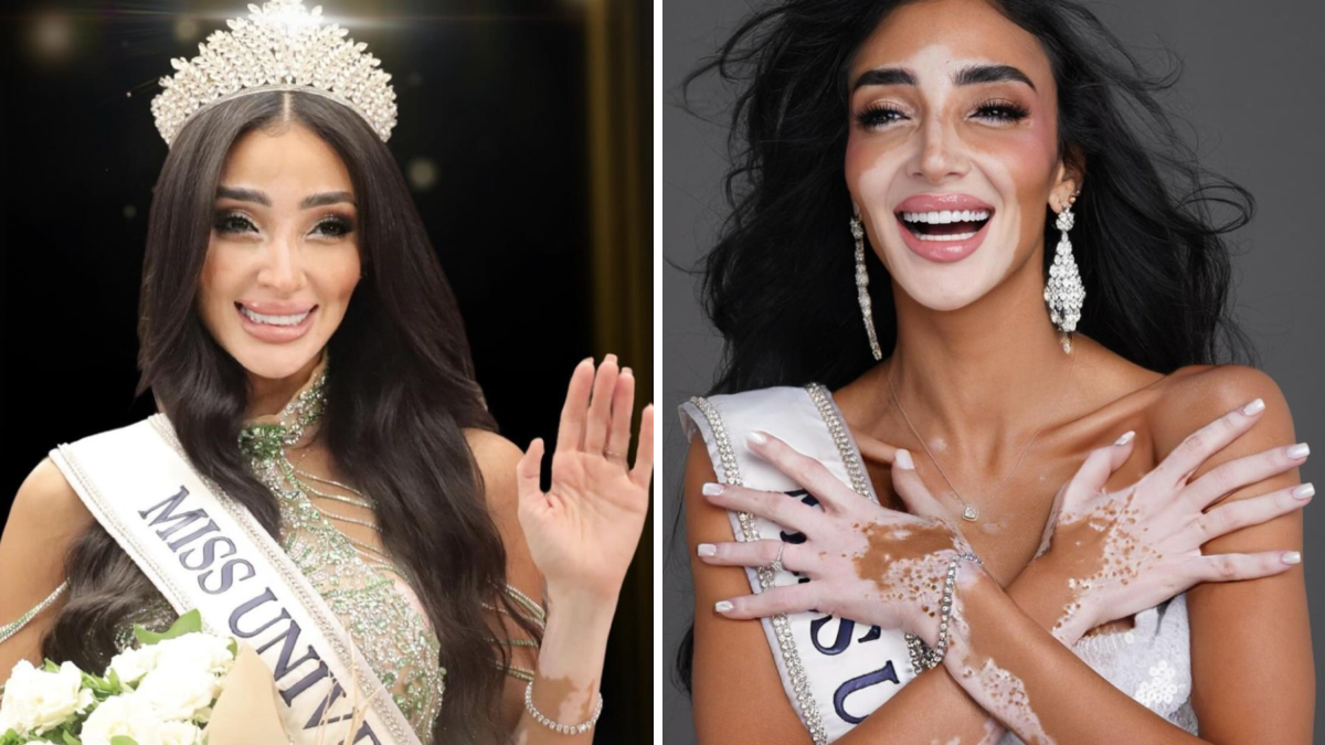 Logina Salah, primera concursante con vitiligo de Miss Universo ...